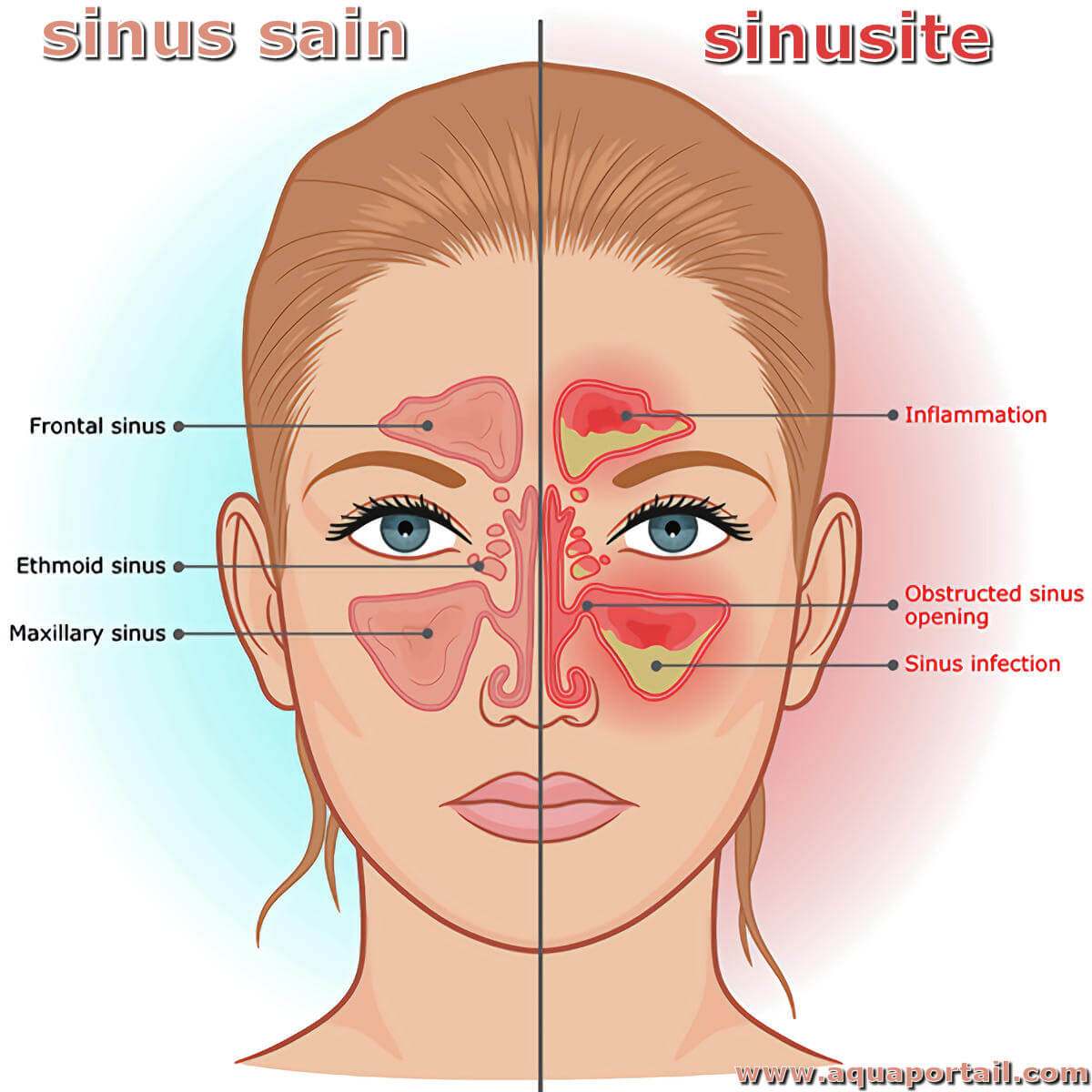 Sinus D finition Et Explications Sinus D finition Et Explications